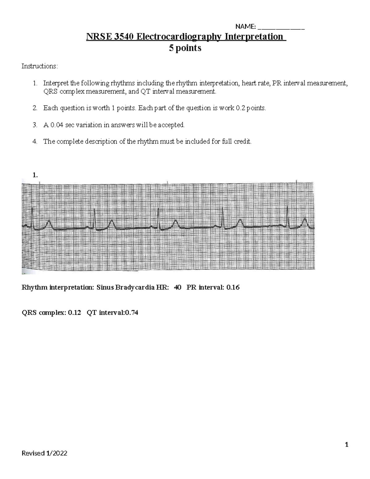 Electrocardiography Interpretation 1 - Interpret the following rhythms ...