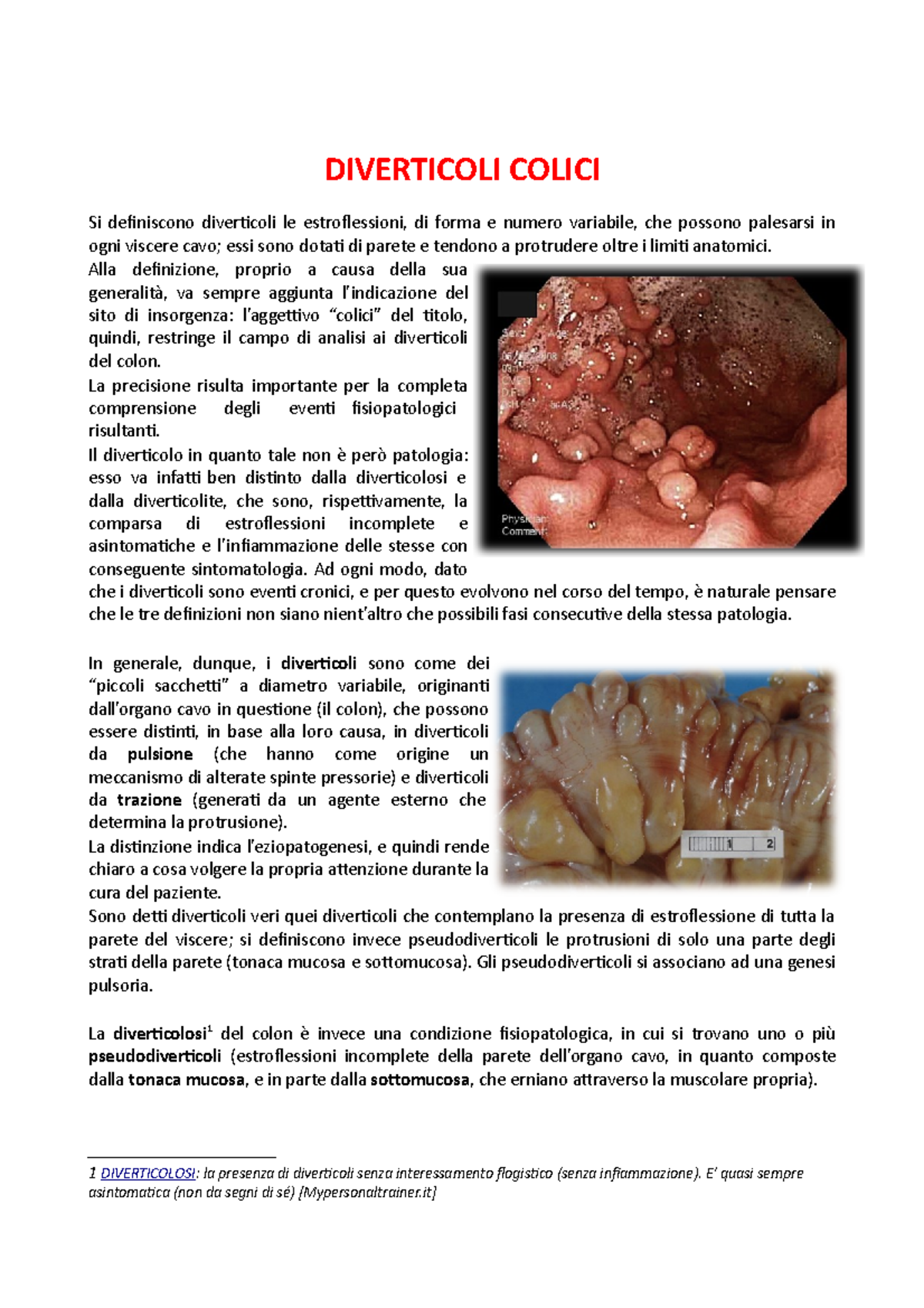 Diverticoli colici - Riassunto FISIOPATOLOGIA GENERALE E - DIVERTICOLI ...
