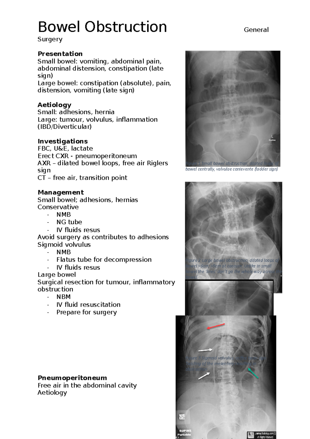 Bowel obstruction 2 - MED 3015 - QUB - Studocu