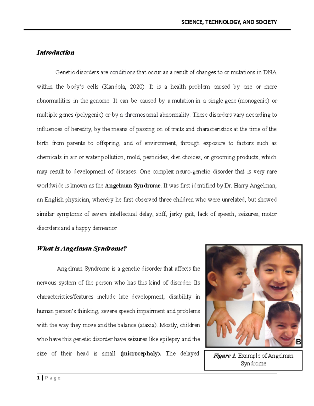 Angelman Syndrome - Introduction Genetic disorders are conditions that ...