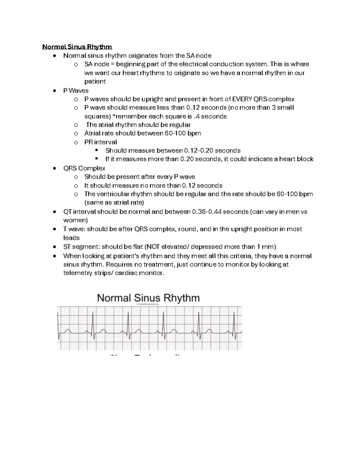 EKG Registered nurse RN - Normal Sinus Rhythm - Normal sinus rhythm ...