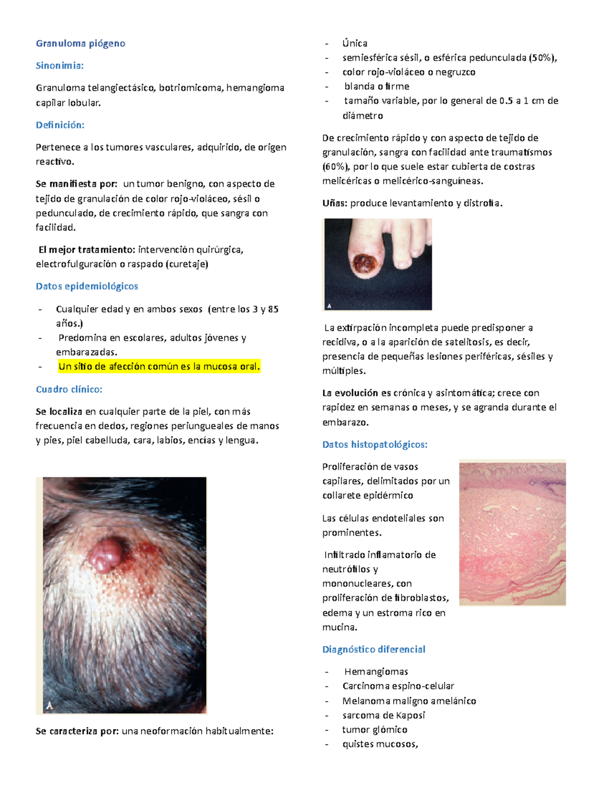 Granuloma piogeno tumores benignos - Granuloma piógeno Sinonimia ...