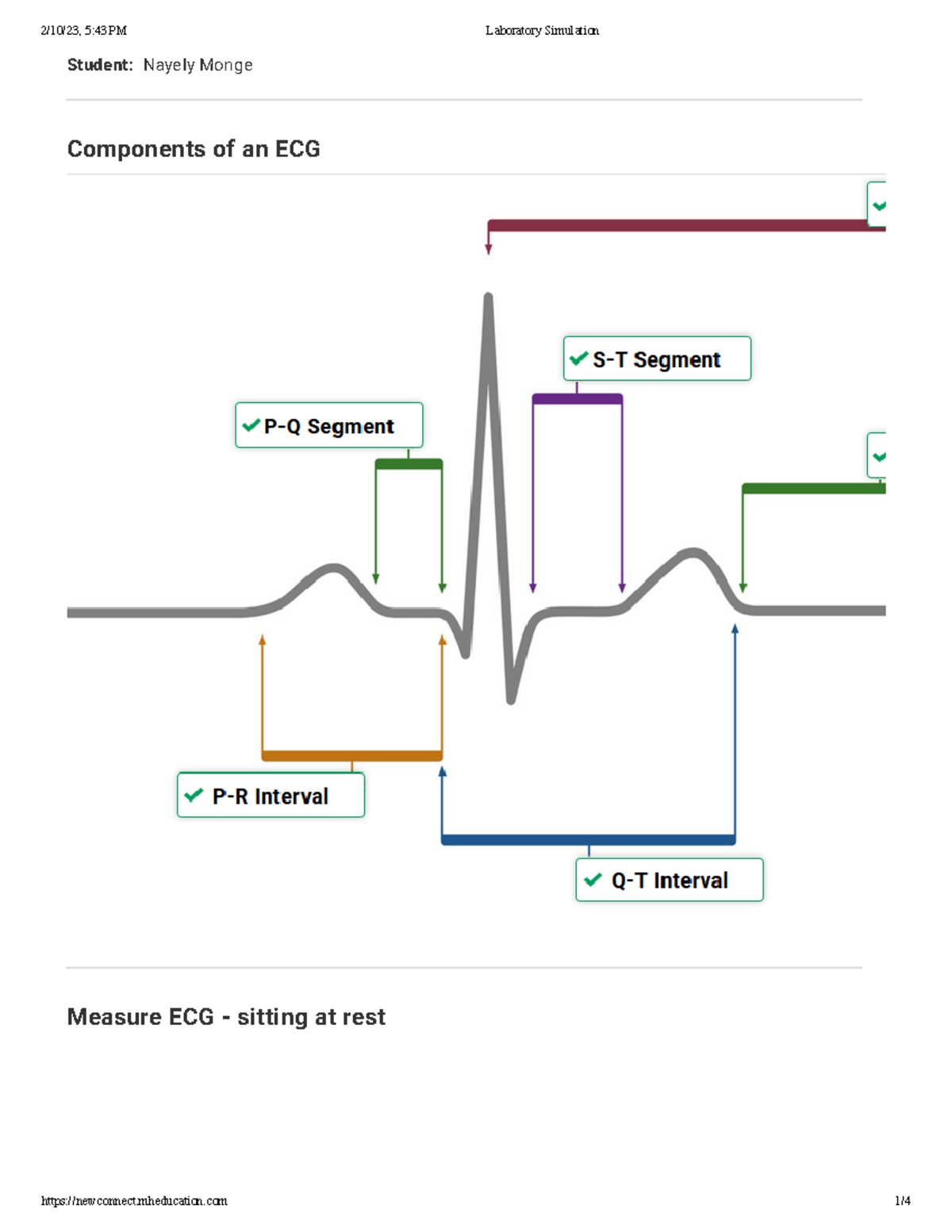 Cardiovascular Physiology- Electrocardiography - Student: Nayely Monge ...