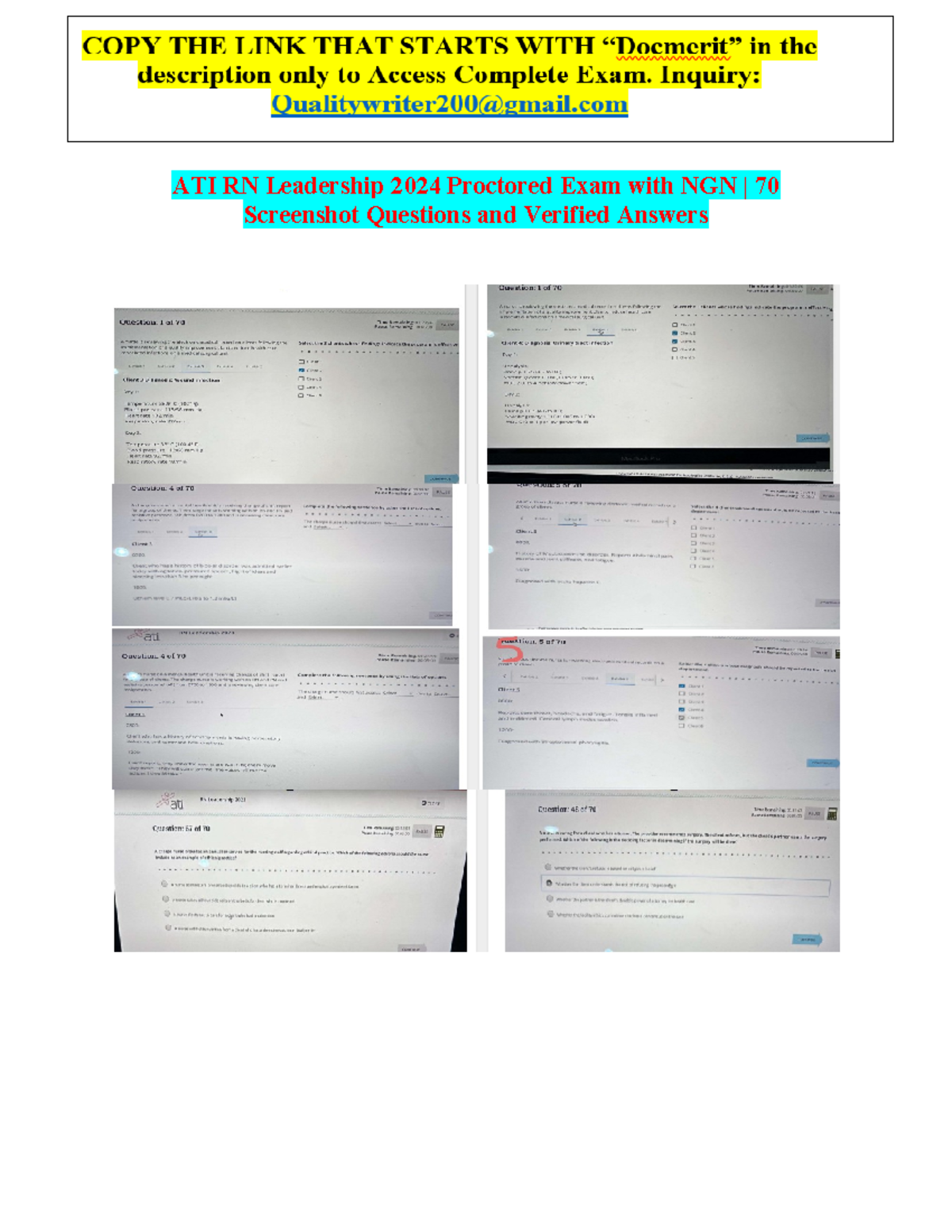 2024 ATI ALL RN Leadership Proctored Exam NGN Questions and CMS ...