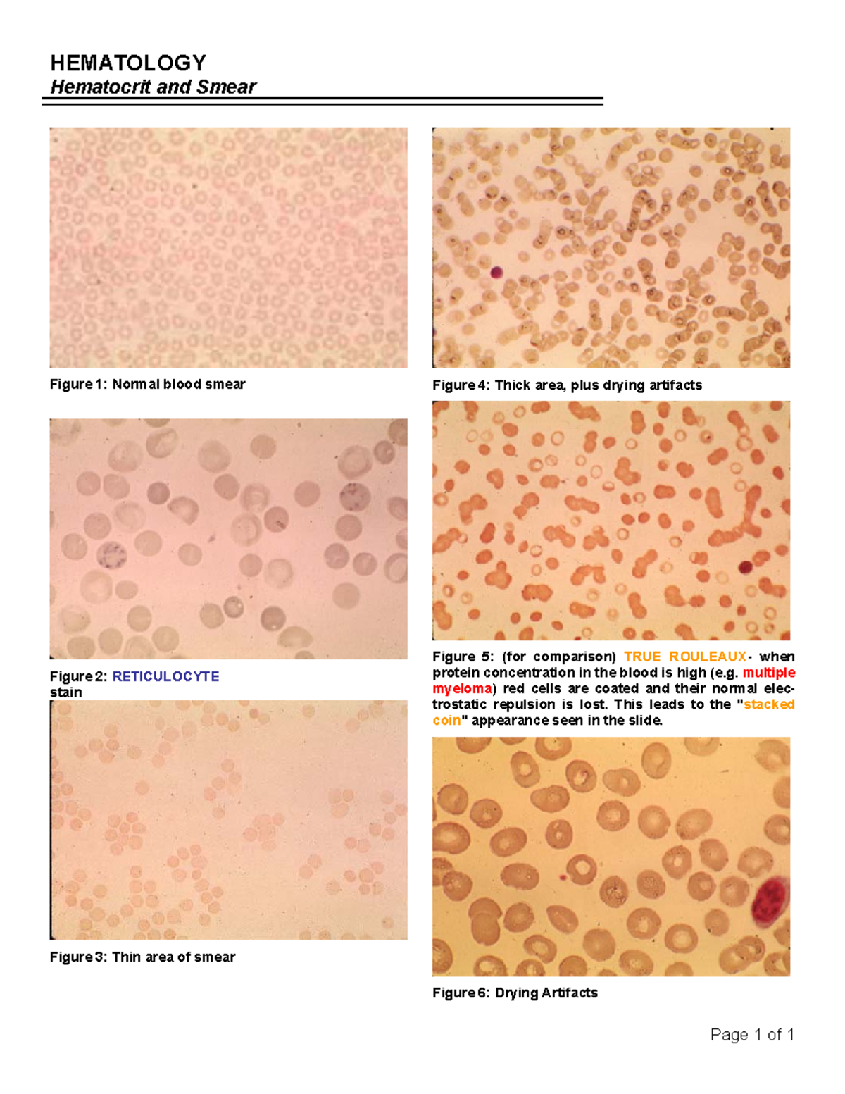 Hematology smears - Compilation of Microscopic images of blood ...