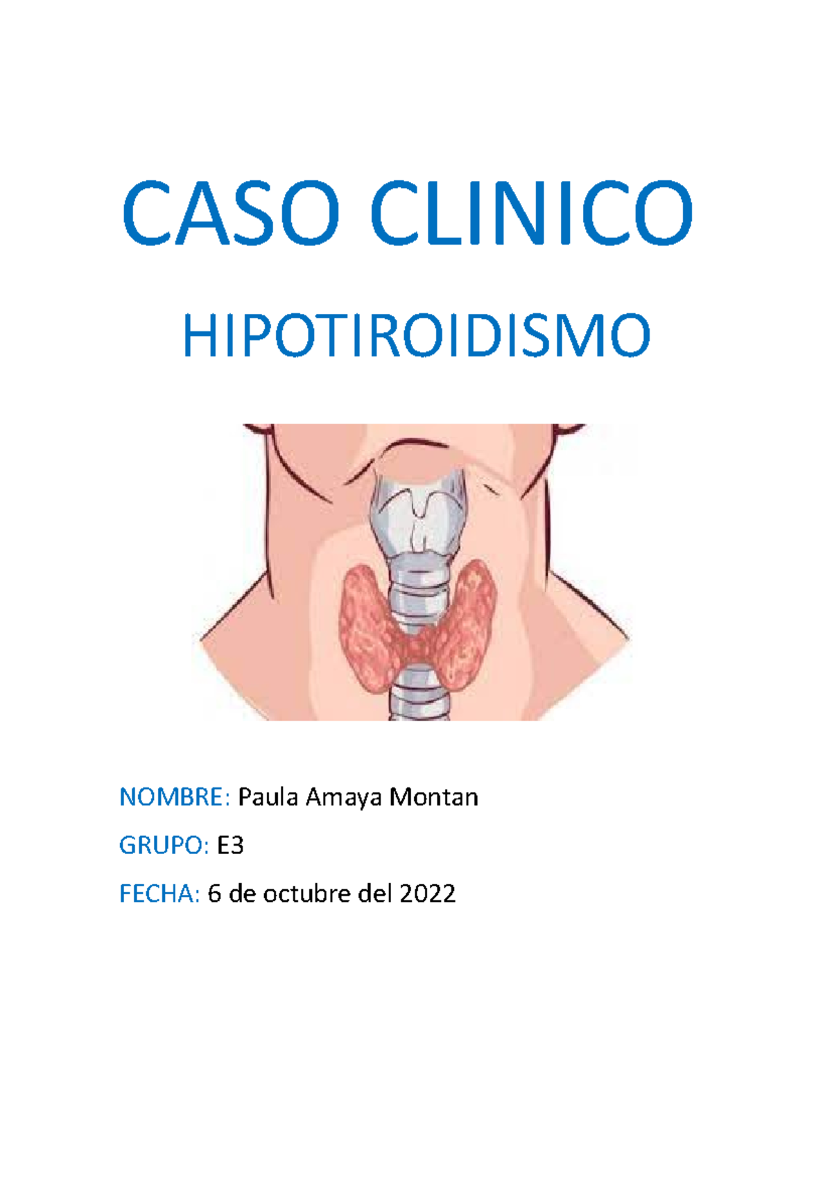 Hipotiroidismo caso clinico - CASO CLINICO HIPOTIROIDISMO NOMBRE: Paula Amaya Montan GRUPO: E ...