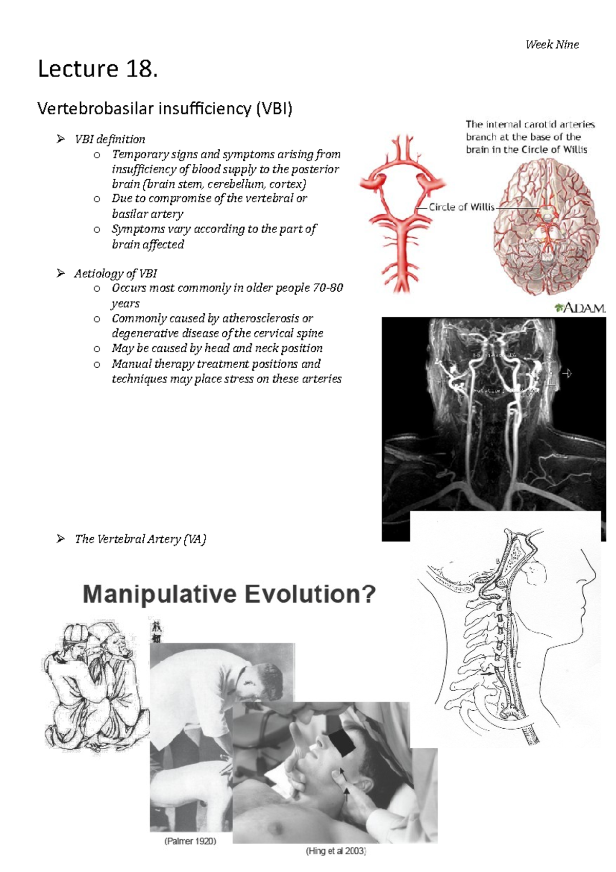 PHTY2020 Lecture 18 - Summary Notes - Lecture 18. Vertebrobasilar ...