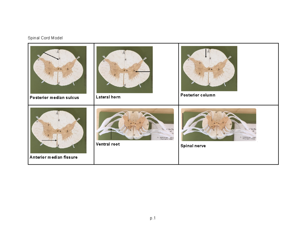 Study Guide Lab 8 - Spinal Cord Model Posterior median sulcus Lateral ...