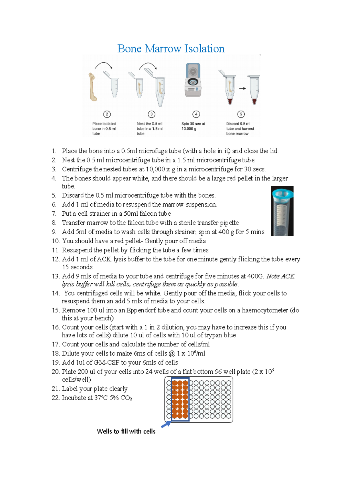 91180 Bone Marrow Isolation method - Bone Marrow Isolation Place the ...