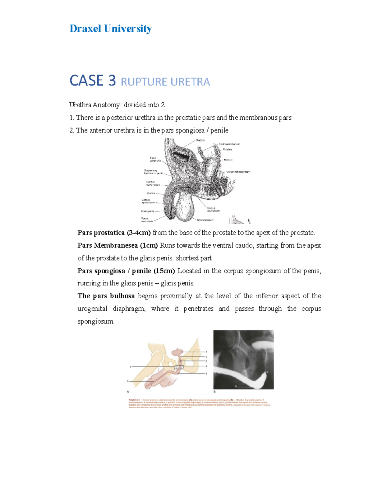 Lecturer Notes Rupture Uretra Part 1 - CASE 3 RUPTURE URETRA Urethra ...