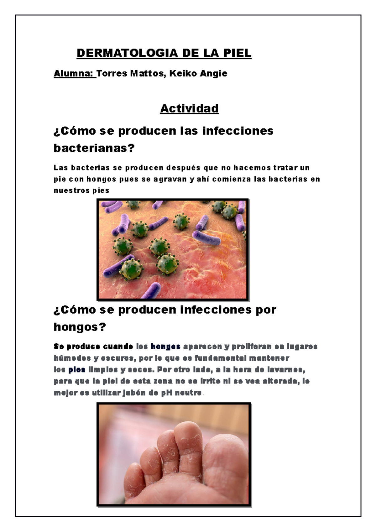 Dermatologia DE LA PIEL - DERMATOLOGIA DE LA PIEL Alumna: Torres Mattos ...