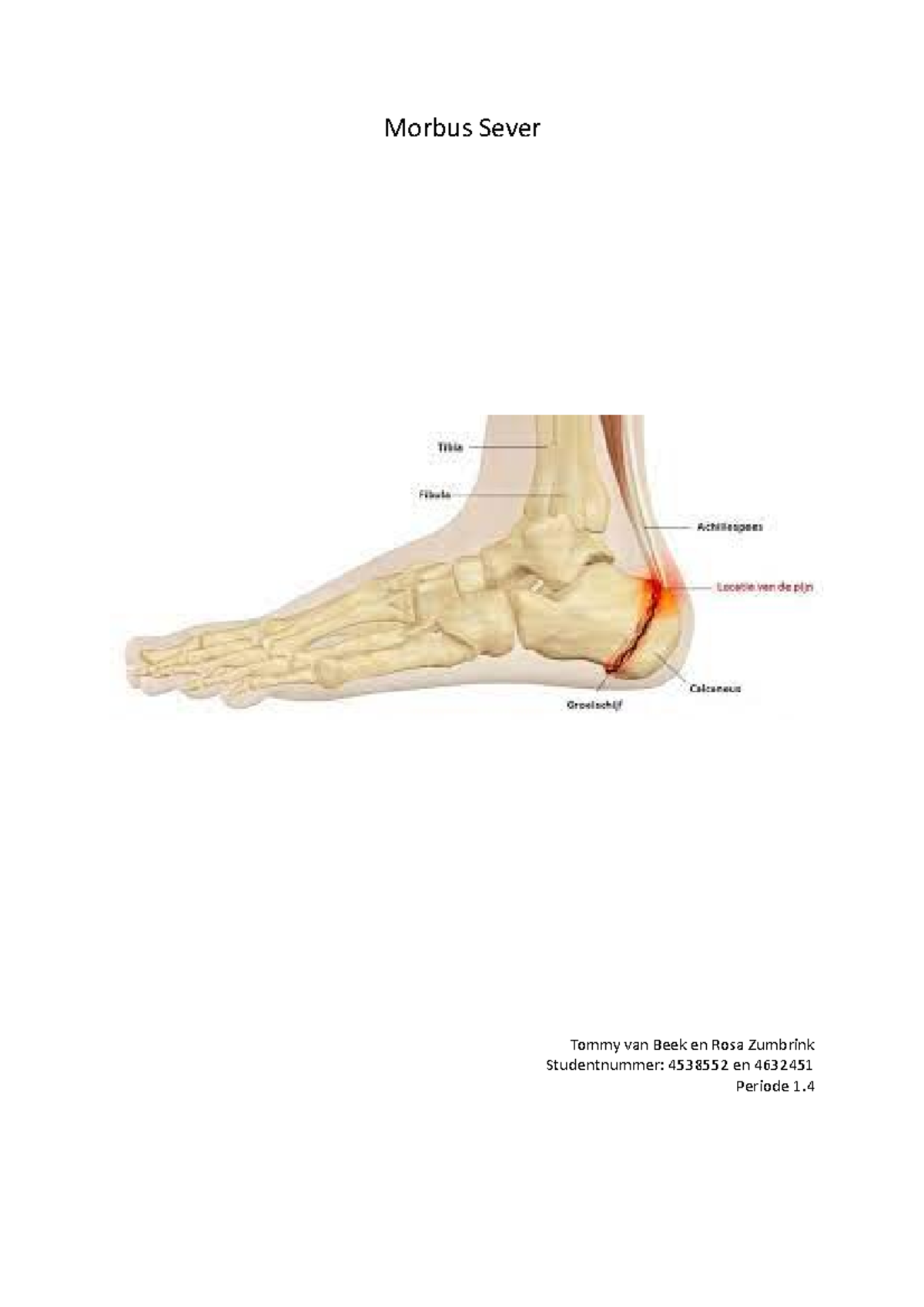 Morbus Sever - Morbus Sever Tommy van Beek en Rosa Zumbrink ...