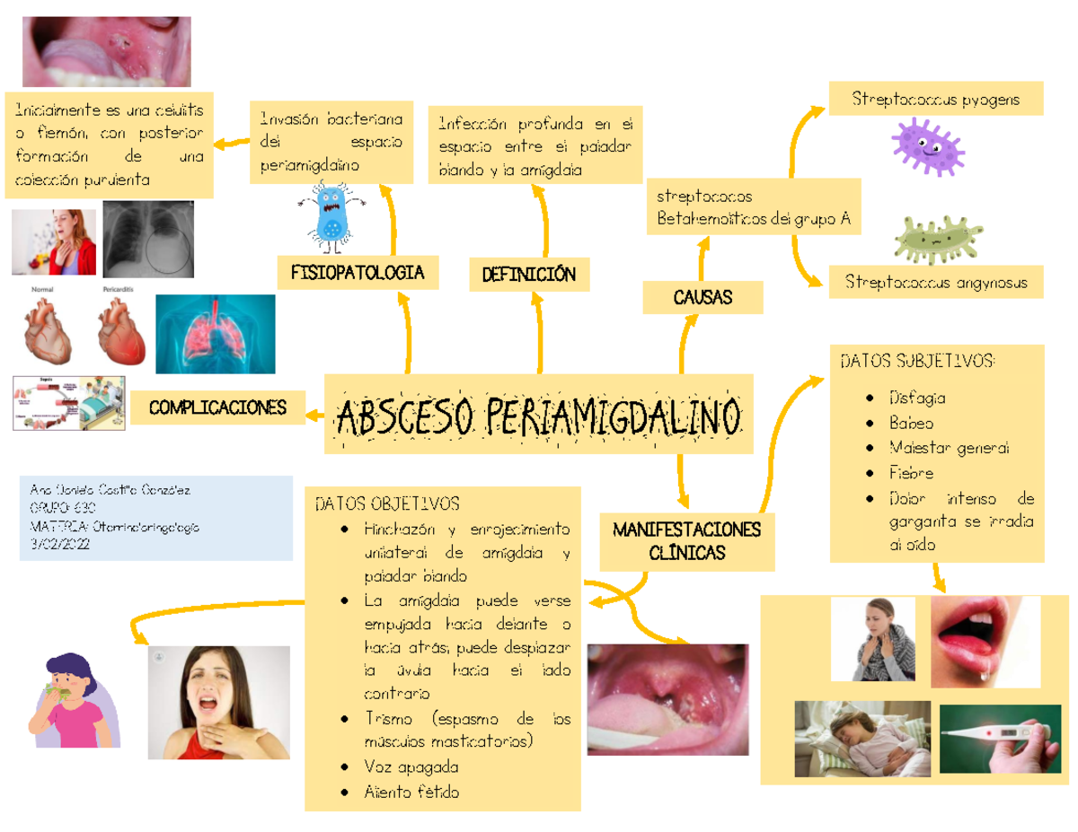 Absceso Periamigdalino - Otorrinolaringlogía - UW - Studocu