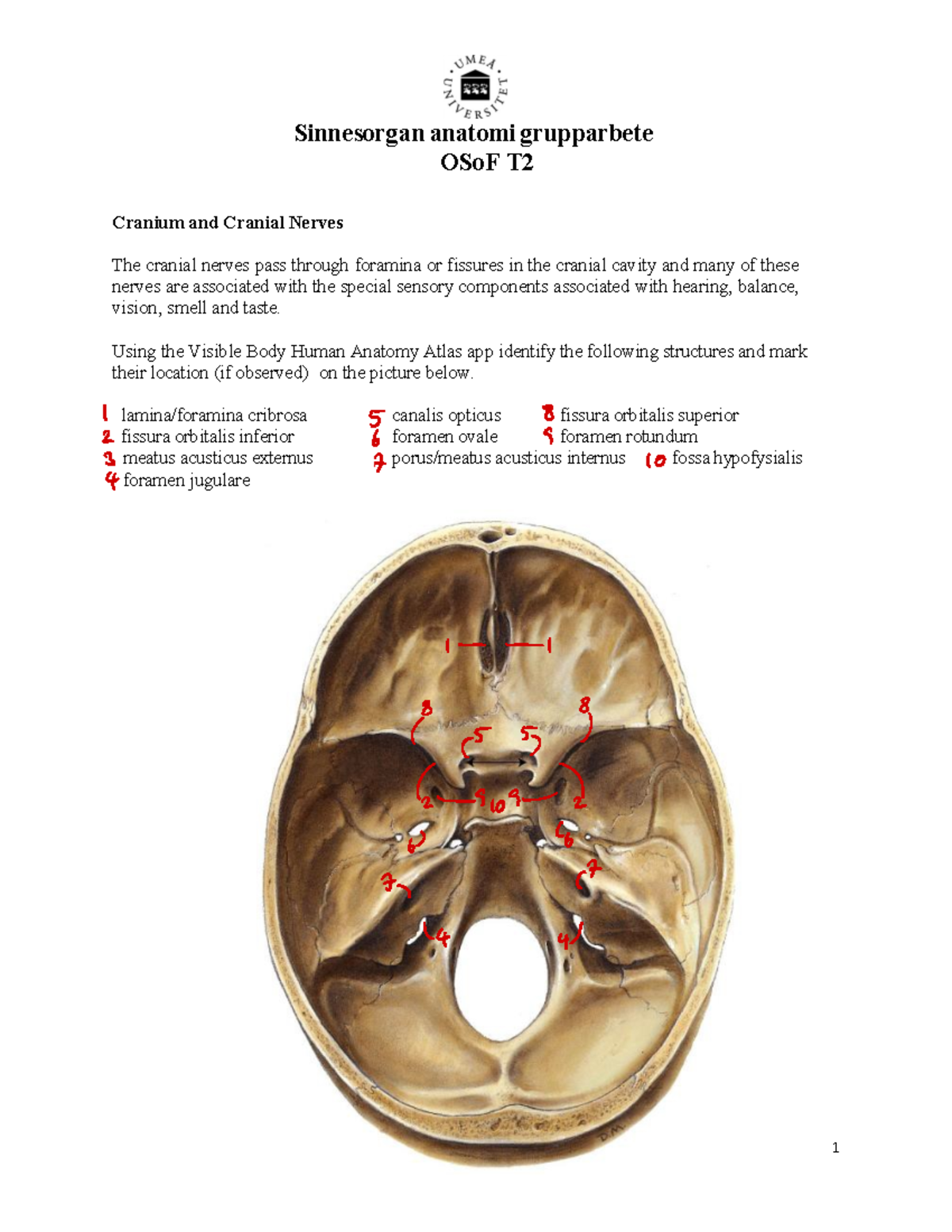 Gruppstudier - Sinnesorganen - ####### Sinnesorgan anatomi grupparbete ...
