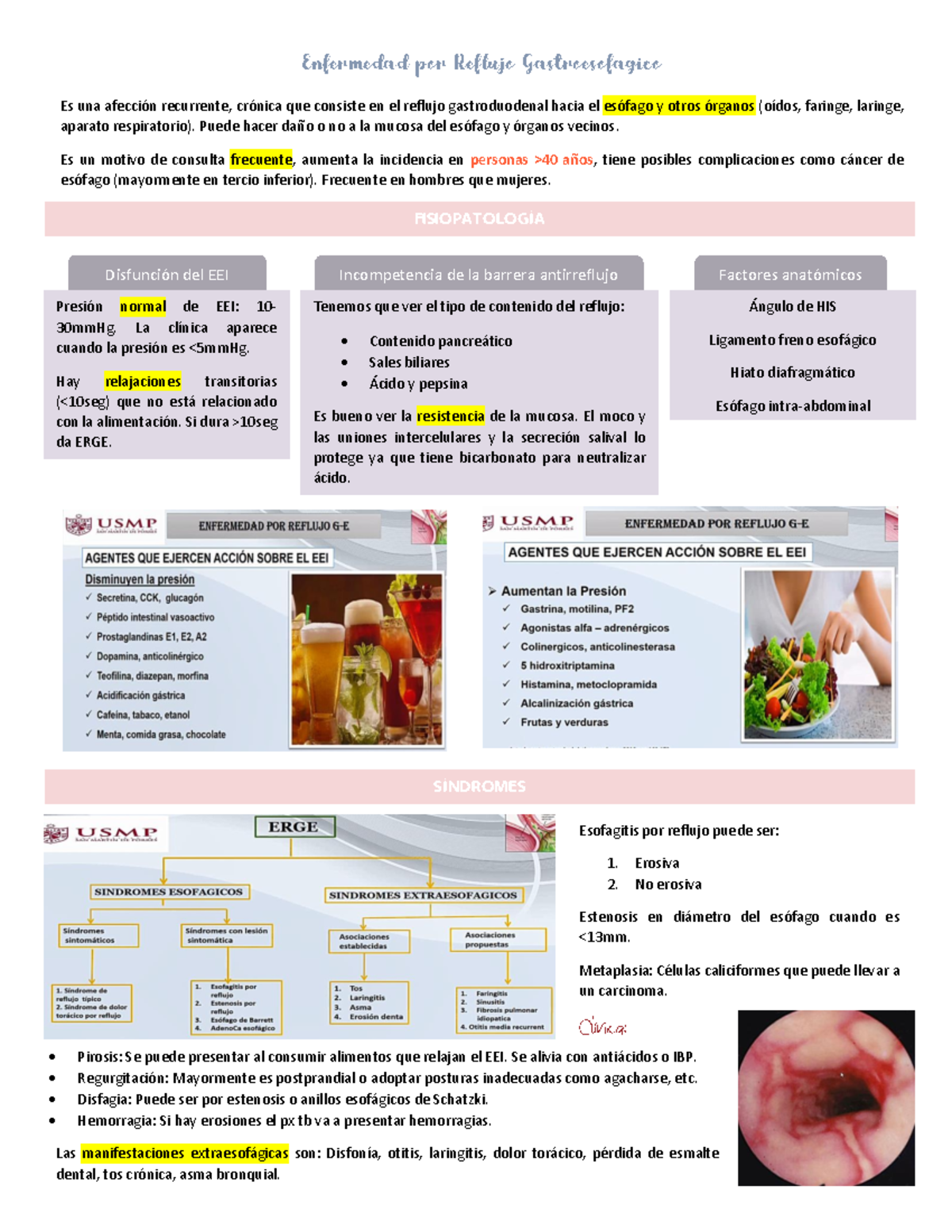 54. ERGE - Resumen de ERGE. - Enfermedad por Reflujo Gastroesofágico Es ...