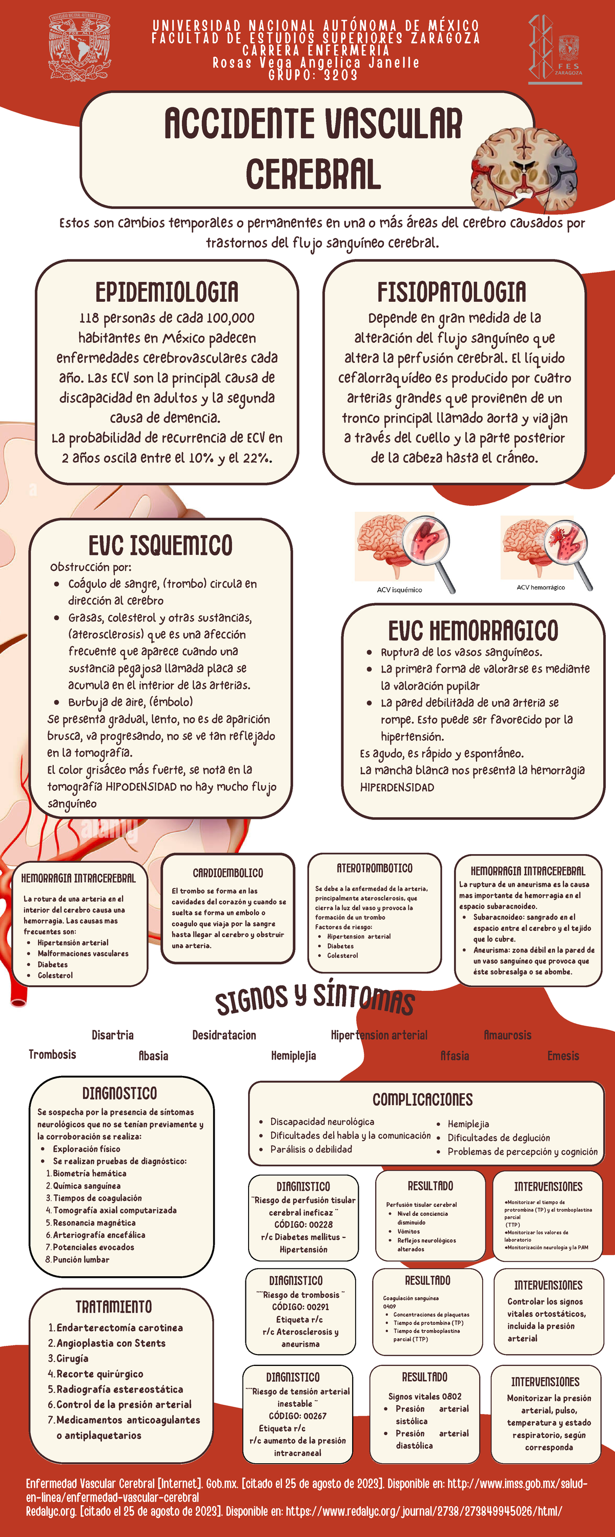 Infografía EVC Isquémico y Hemorrágico - 118 personas de cada 100 ...