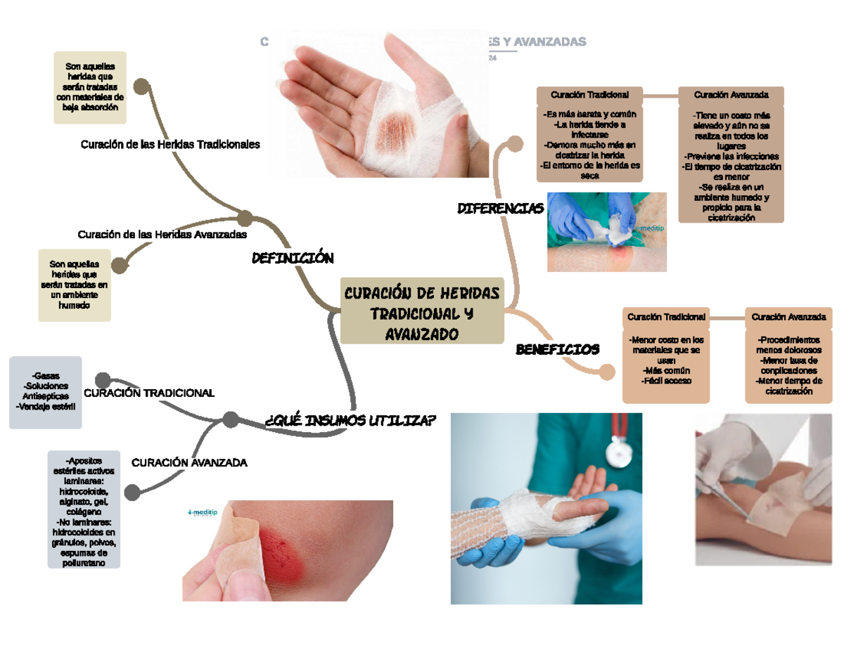 Curacion de heridas tradicional y avanzada MAPA - Cur ación de her idas ...
