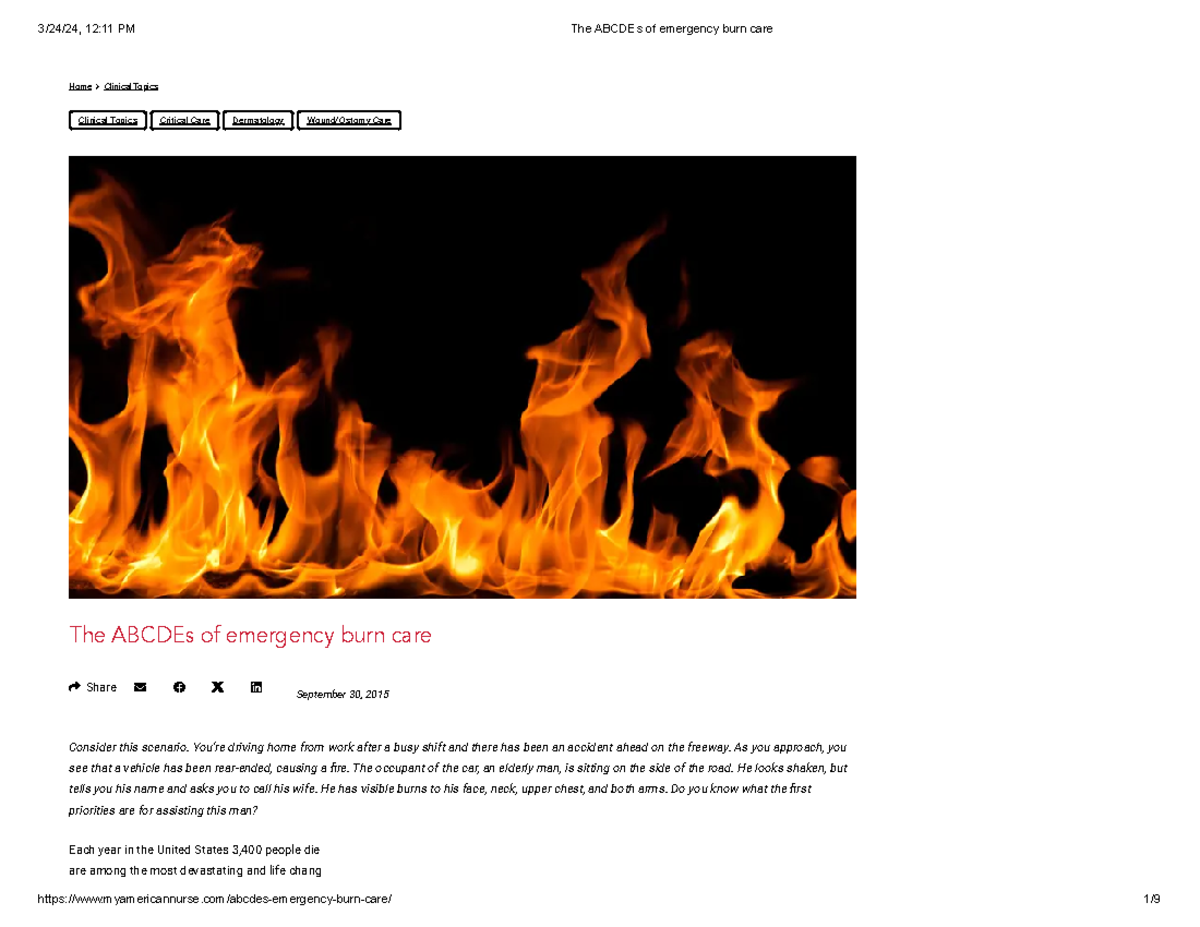 The Abcdes of emergency burn care - Share Home Clinical Topics The ...