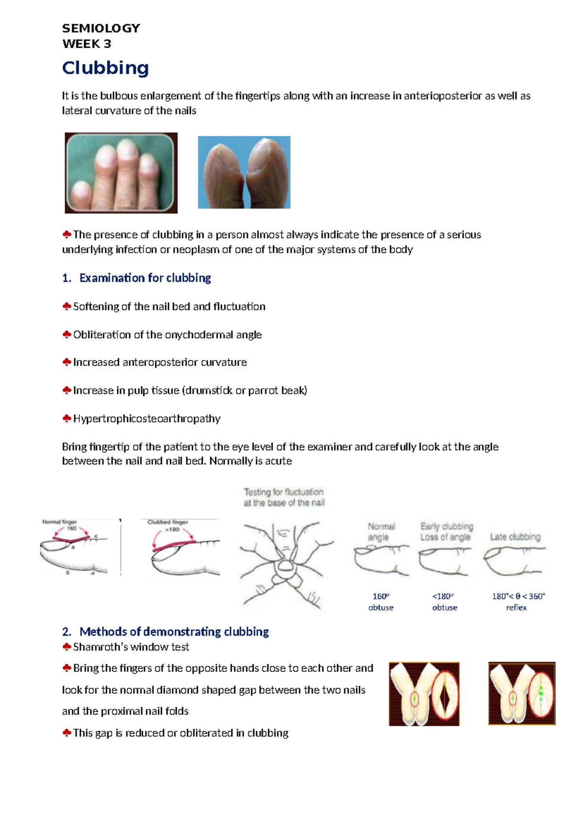 week 3-semiology-respiratory - SEMIOLOGY WEEK 3 Clubbing It is the ...