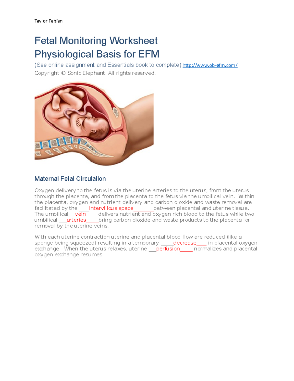 Fetal Monitoring Worksheet - Fetal Monitoring Worksheet Physiological ...
