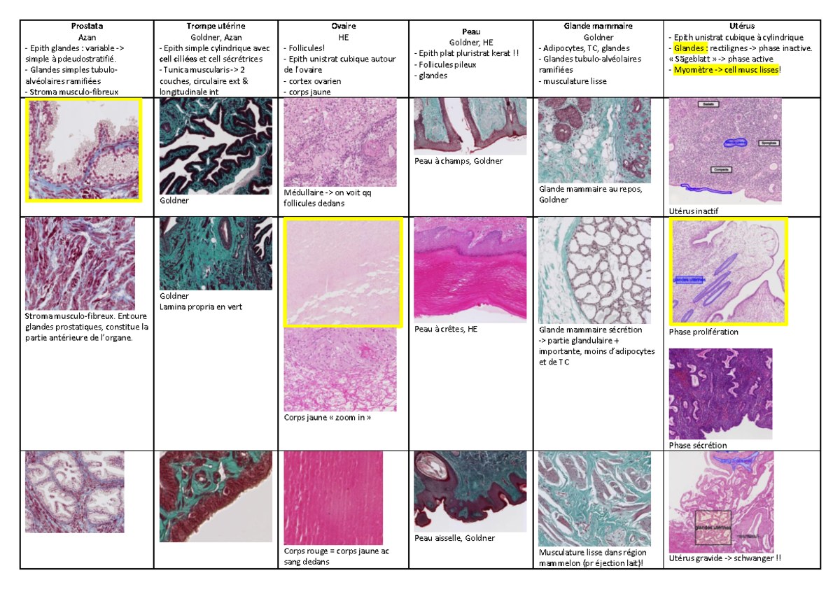 Histo Tissue array - Herbstsemester - Prostata Azan Epith glandes ...