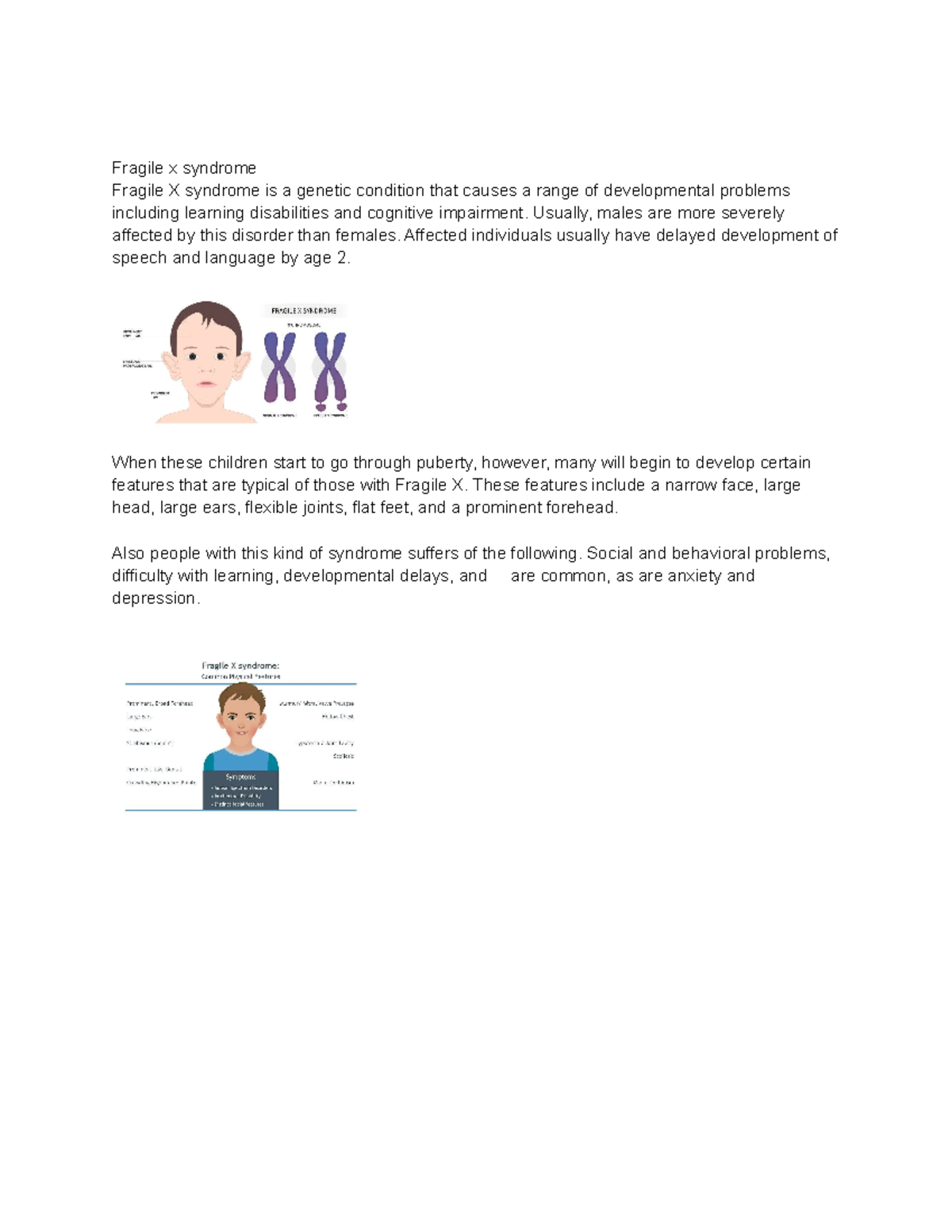 Fragile x syndrome - Fragile x syndrome Fragile X syndrome is a genetic ...