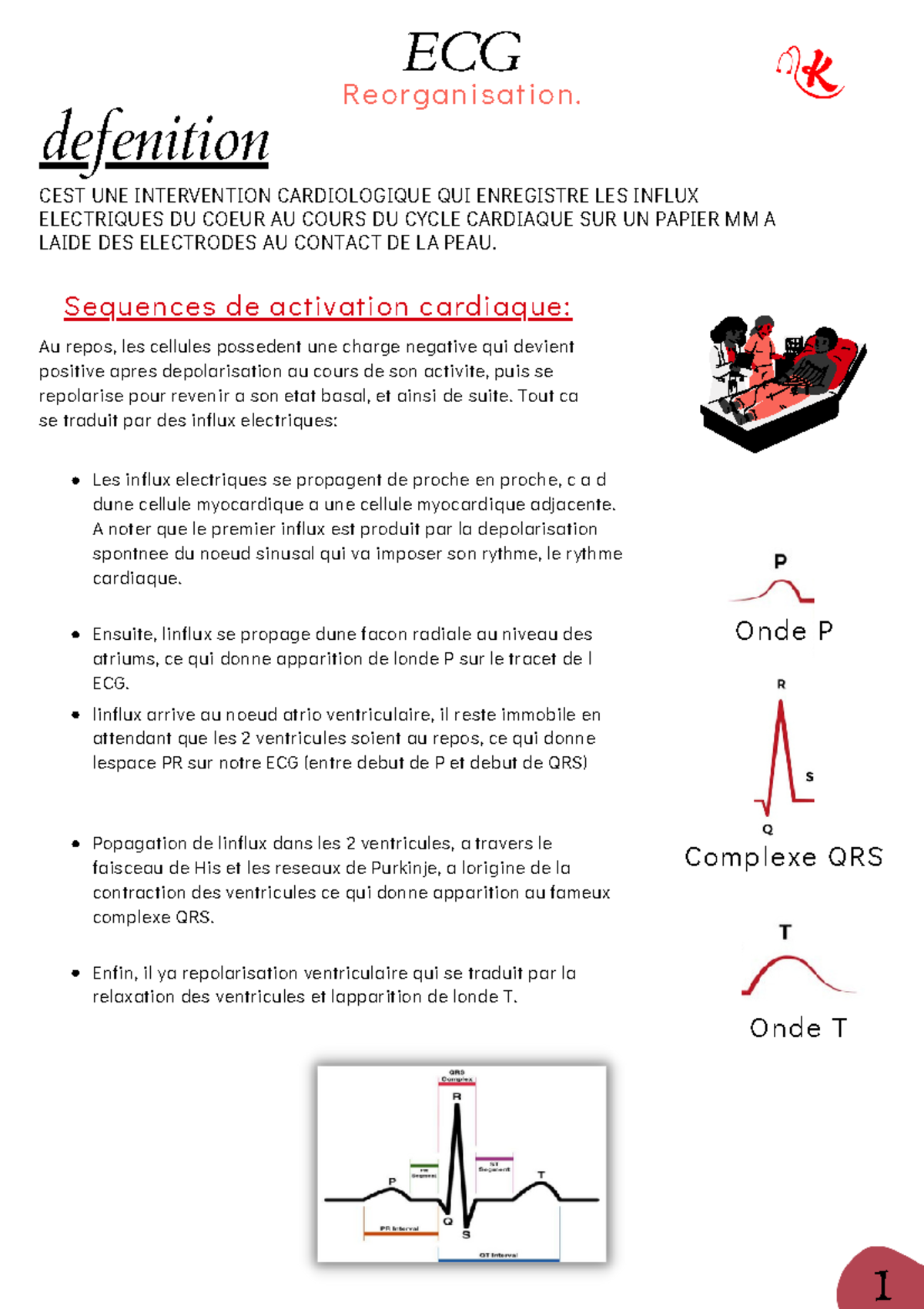 Reorganisation ECG - ecg - ECG Reorganisation. defenition CEST UNE ...