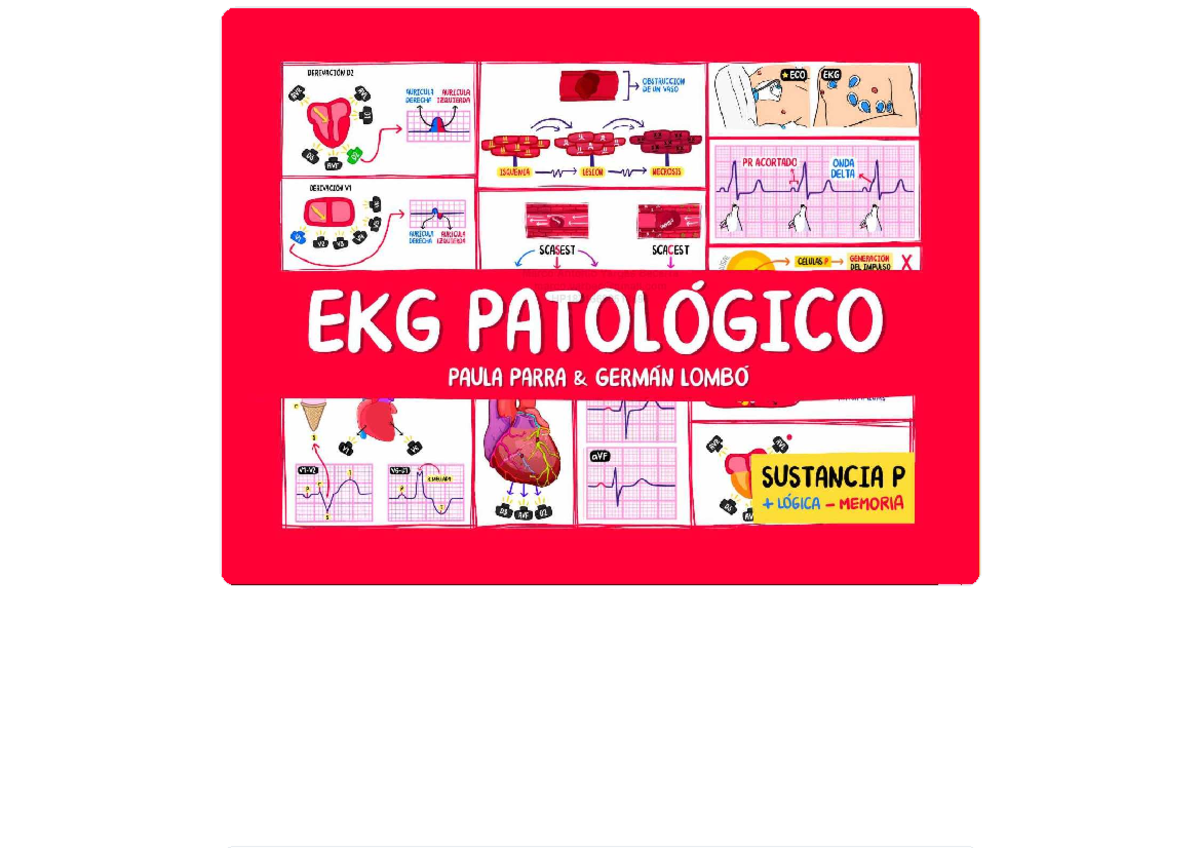 Ekg-patologico-sustancia-p compress - Fisiopatología - Studocu Ekg-patologico-sustancia-p compress - Fisiopatología - Studocu