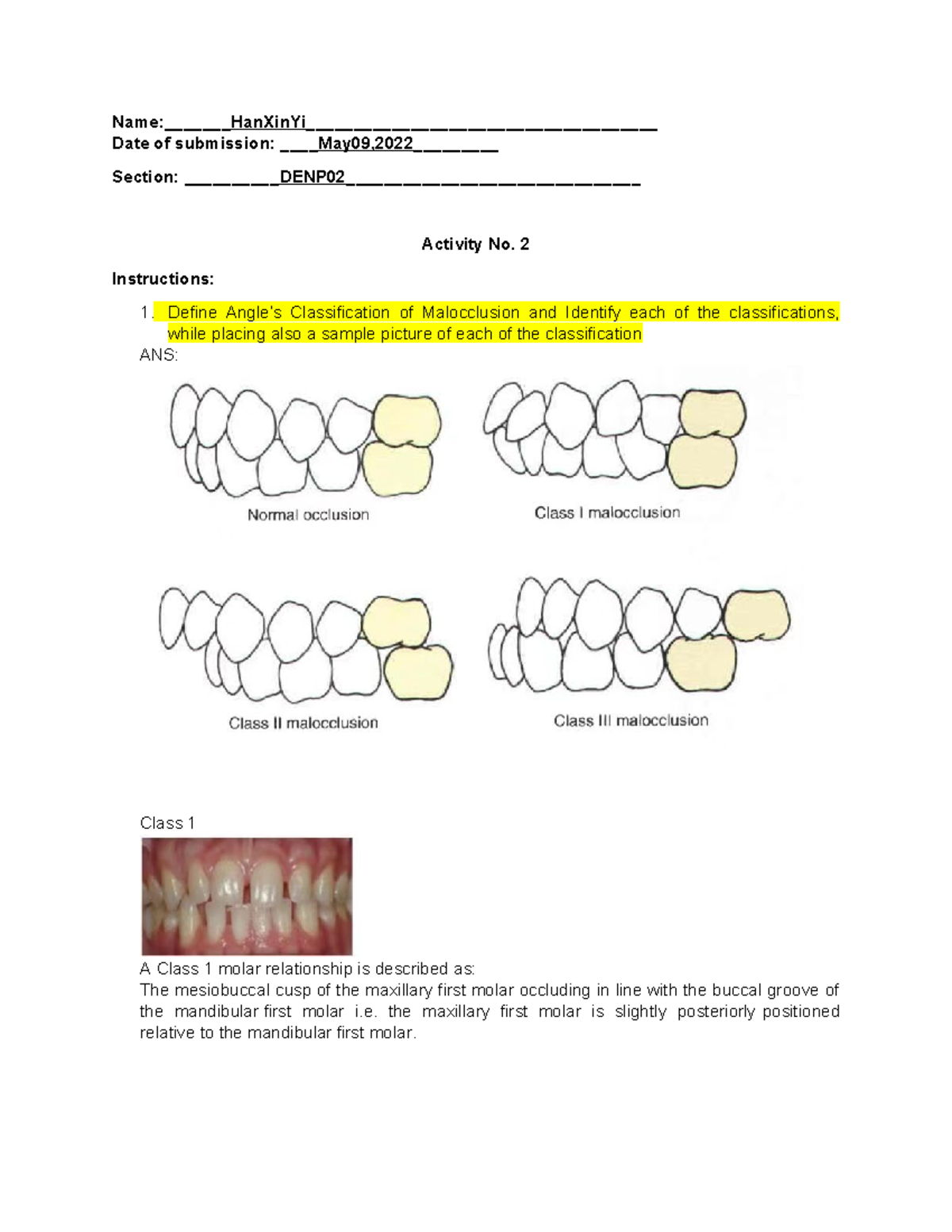 Han Xin Yi-Activity 2 Lecture Ortho 2 - Name:HanXinYi ...