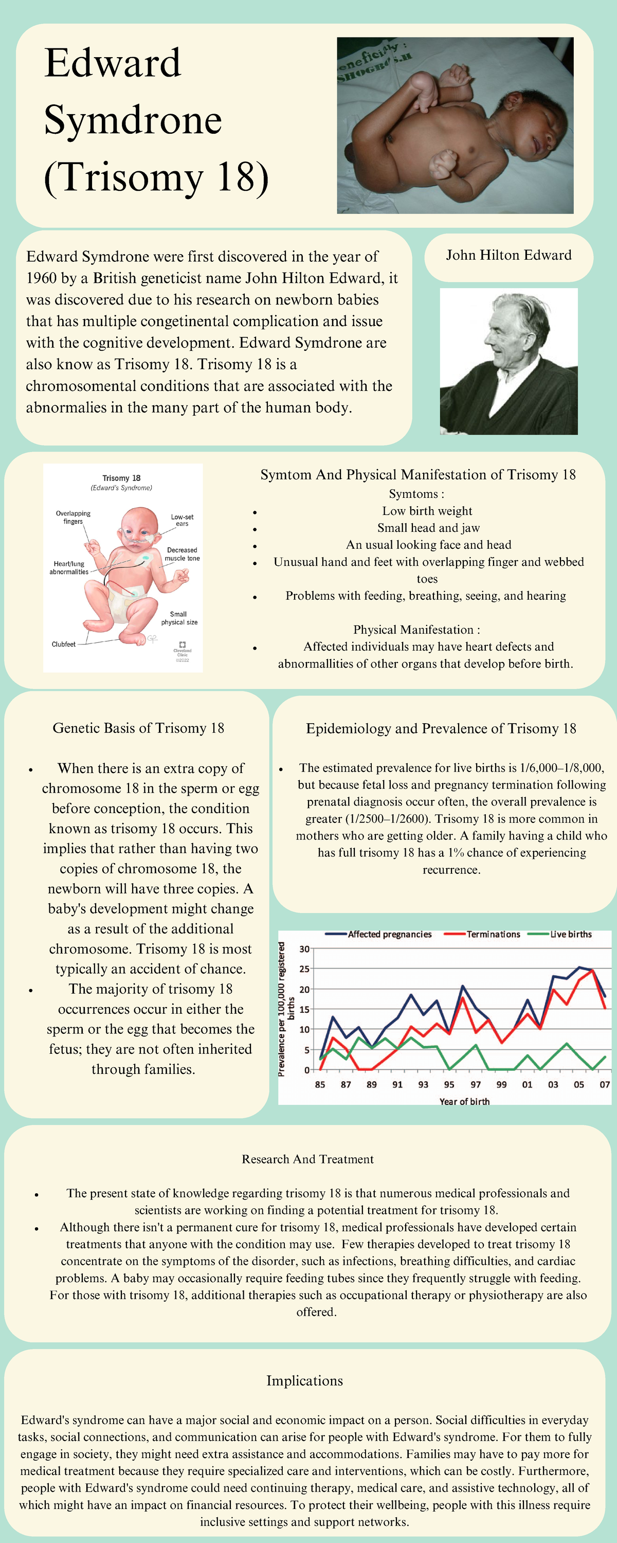 Edward Symdrone (Trisomy 18) - John Hilton Edward Edward Symdrone ...