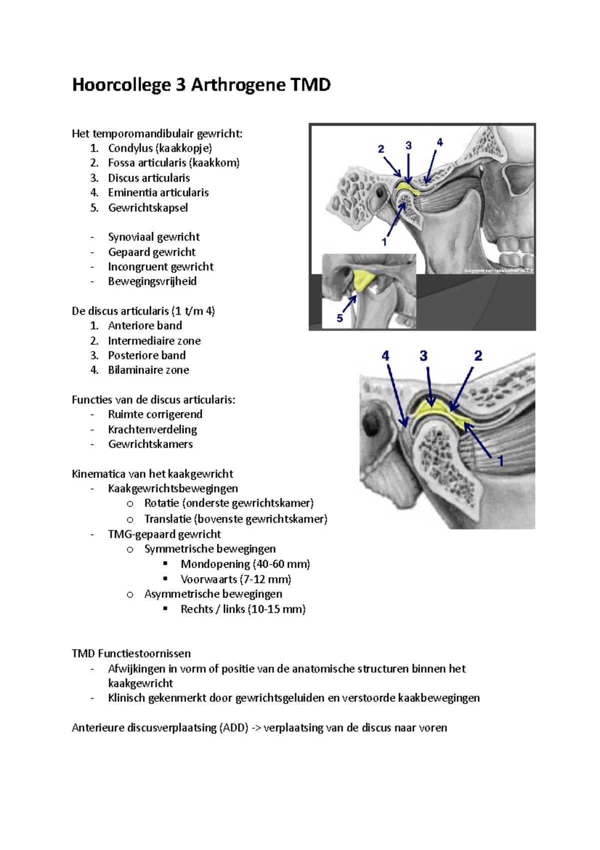 Hoorcollege 3 Arthrogene TMD - Condylus (kaakkopje) 2. Fossa ...