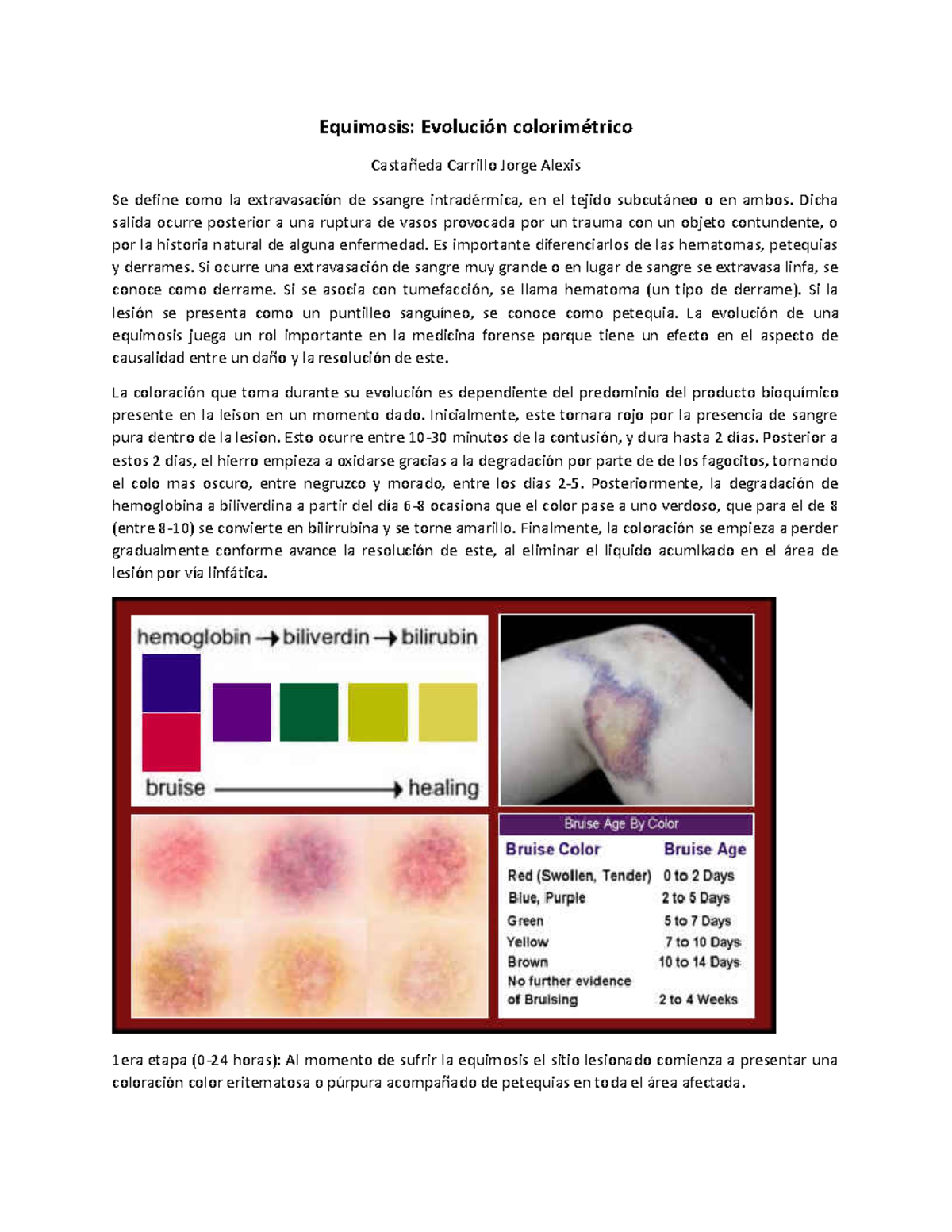 Equimosis-evolucion colorimetrica - Equimosis: Evolución colorimétrico ...