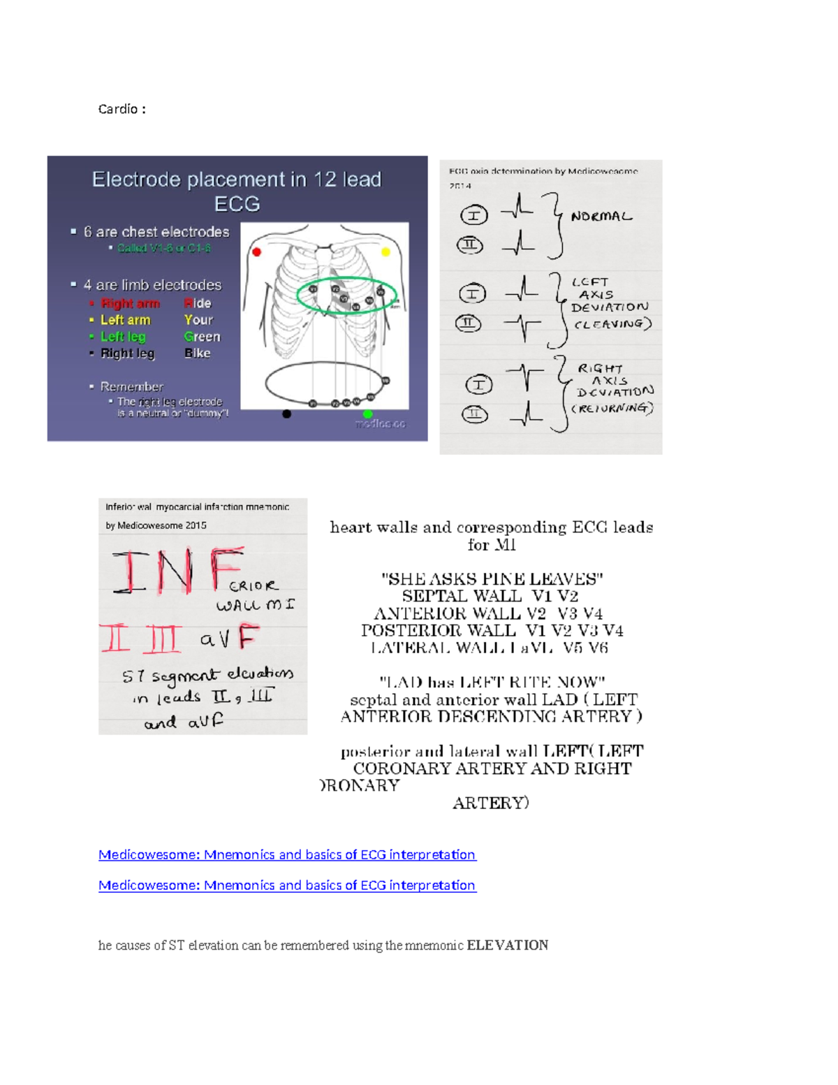 Internal-mn - internal medicine mnemonic - Cardio : Medicowesome: Mnemonics and basics of ECG ...