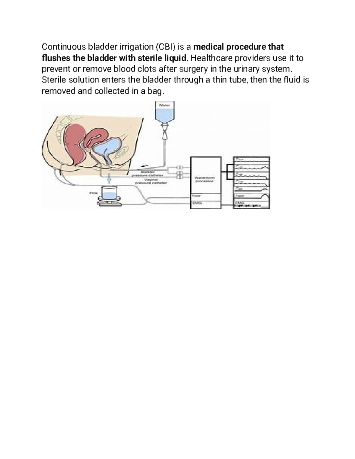 Continuous-bladder-irrigation - Reading and thinking skills for ...