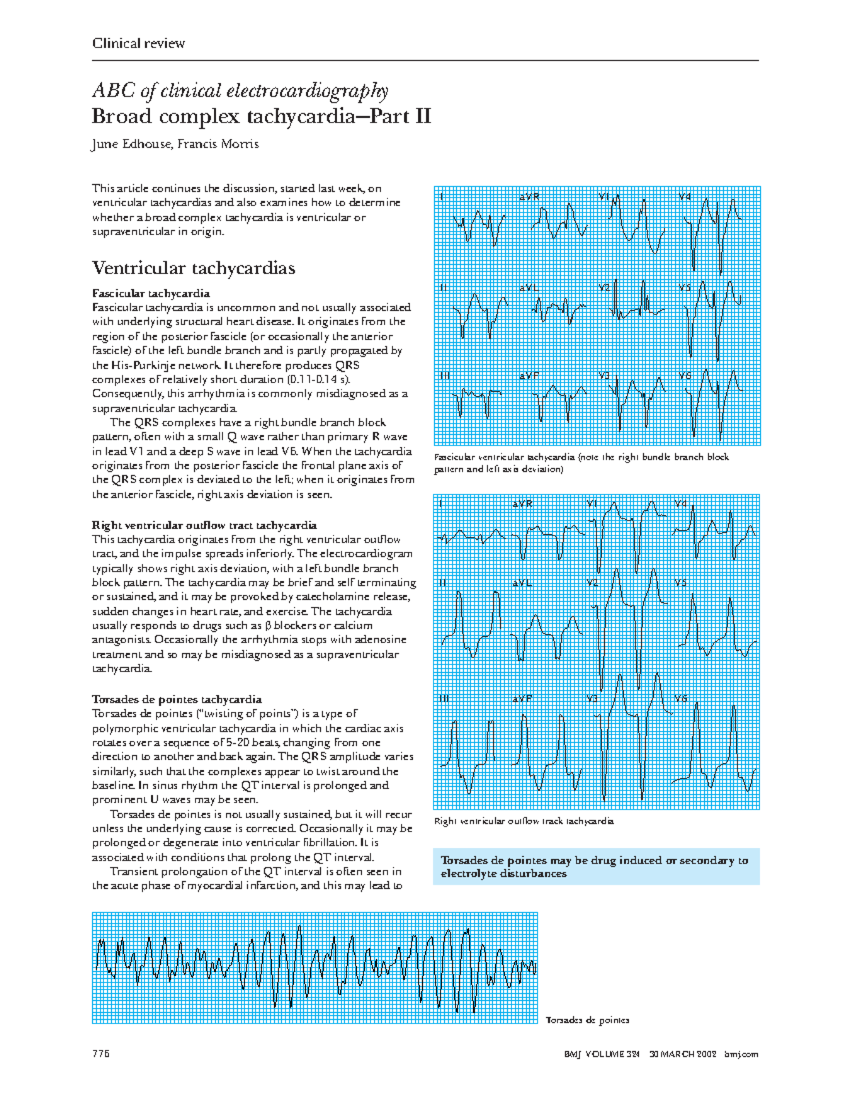 ABC DE ECG Parte 2 - Ele tro - ABC of clinical electrocardiography ...