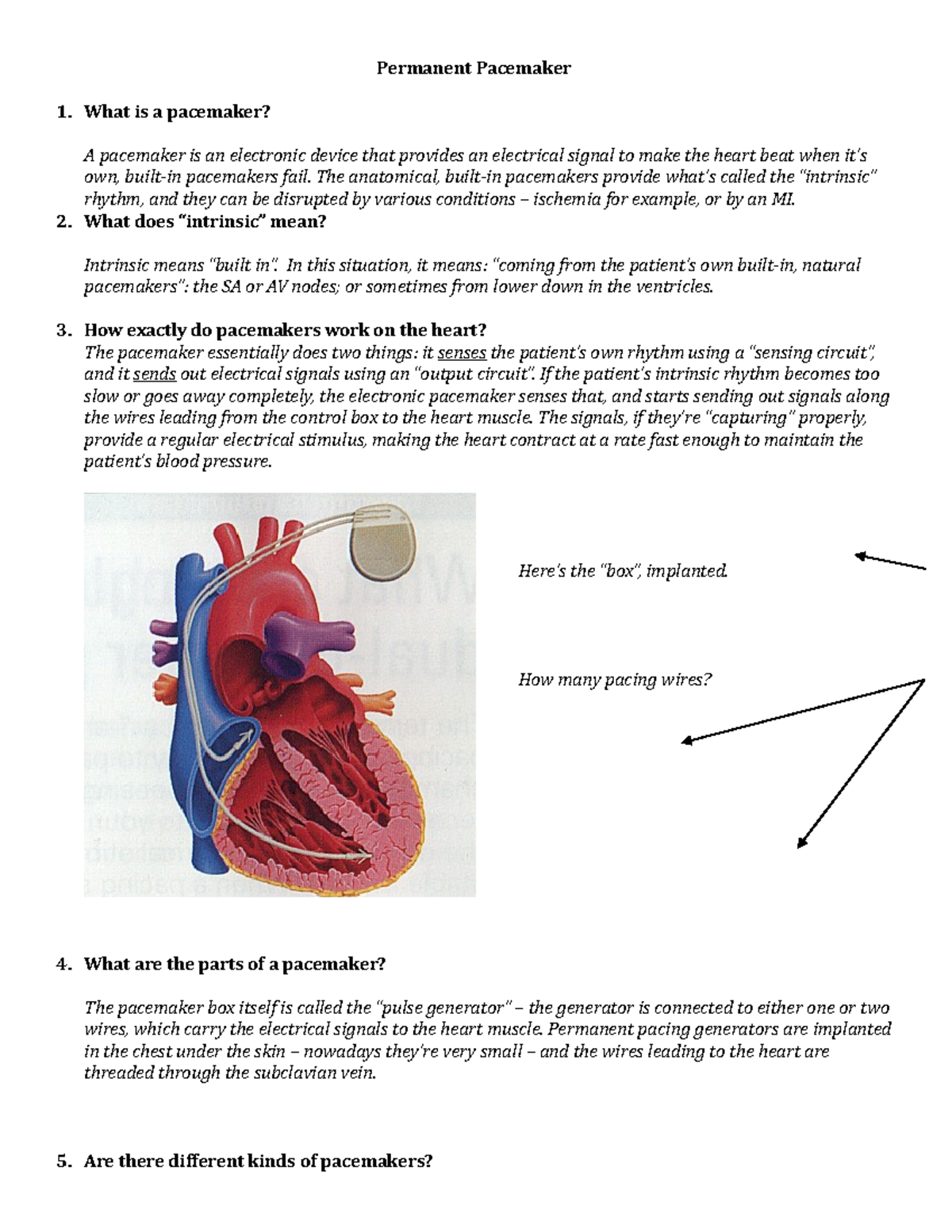 1A Permanent Pacemaker handout - Permanent Pacemaker 1. What is a ...