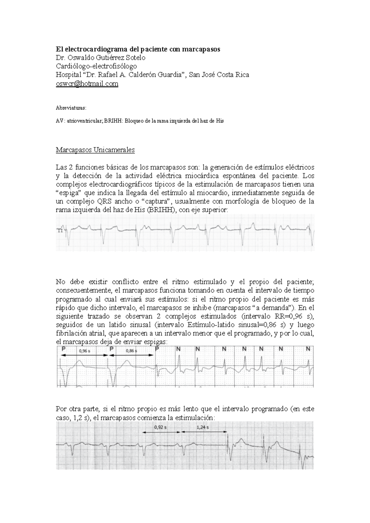 ECG Capitulo 8 El electrocardiograma del paciente con marcapasos - El ...