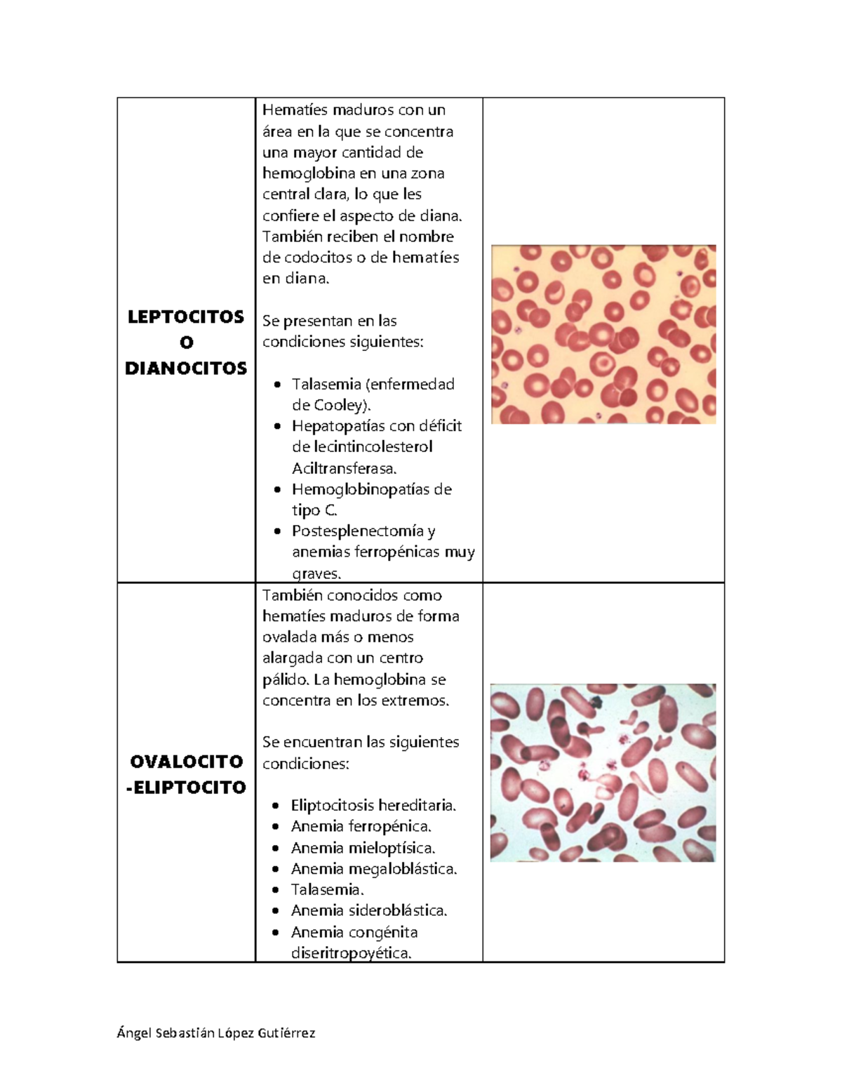 Atlas de heatología - ¡ngel Sebasti·n LÛpez GutiÈrrez LEPTOCITOS O ...