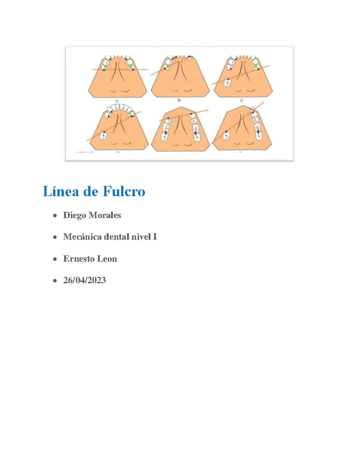 Linea de Fulcro - seccion 206OA - Línea de Fulcro • Diego Morales ...