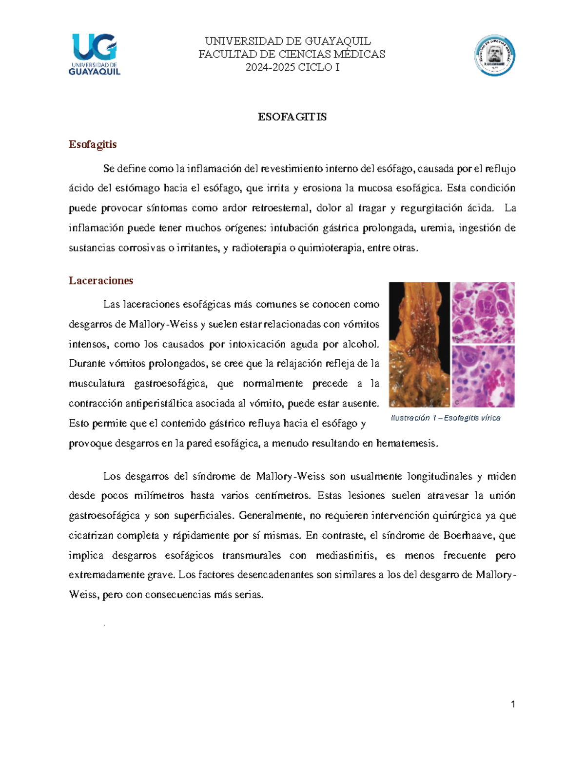 ESOFAGITIS INFECCIOSA ANATOMIA PATOLOGICA - FACULTAD DE CIENCIAS ...