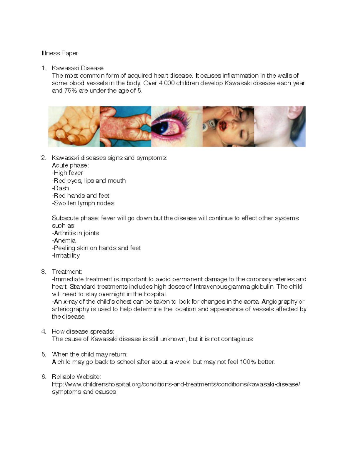 CD 10 illness paper - CD 10 - Illness Paper Kawasaki Disease The most ...