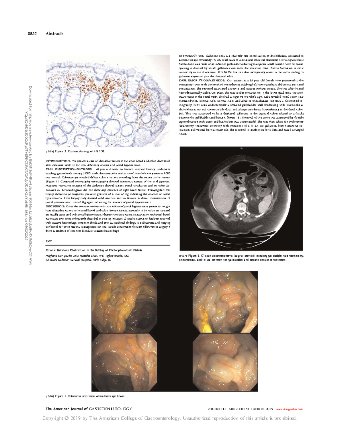 Patologia qx- obstruccion intestinal - INTRODUCTION: We present a case ...