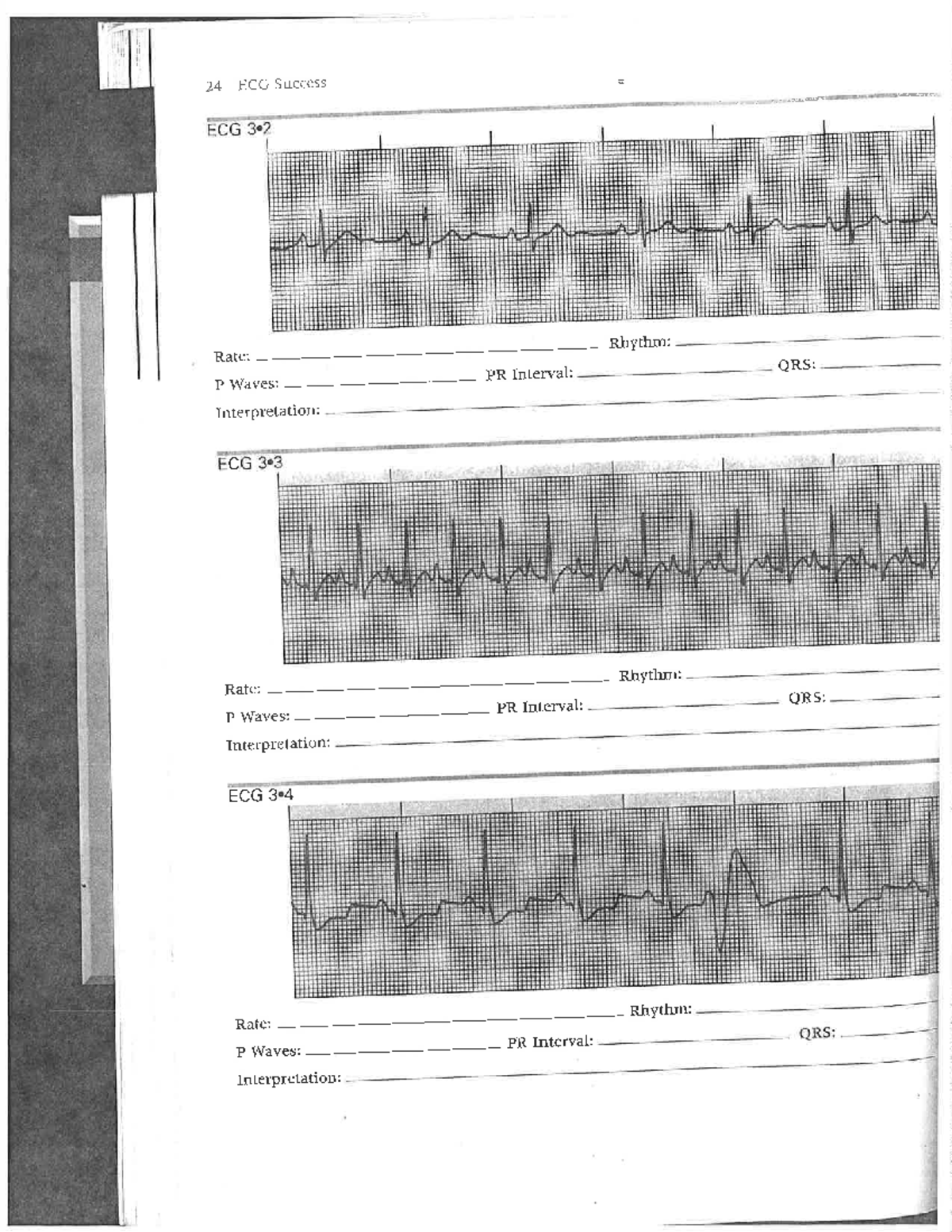 EKG rhythm analysis - NUR1210 - Studocu