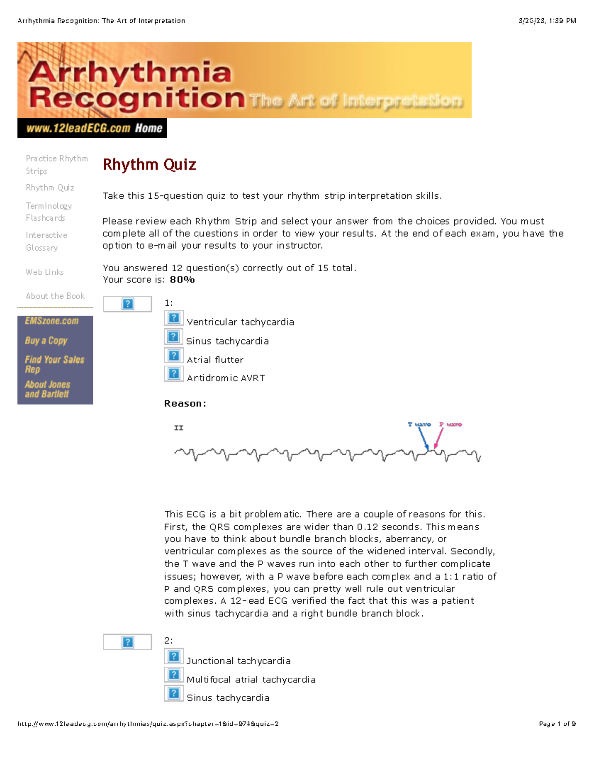 Arrhythmia Recognition: The Art of Interpretation - Practice Rhythm ...