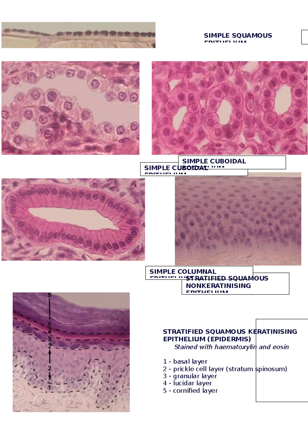Tissue types - SIMPLE SQUAMOUS EPITHELIUM SIMPLE CUBOIDAL SIMPLE ...