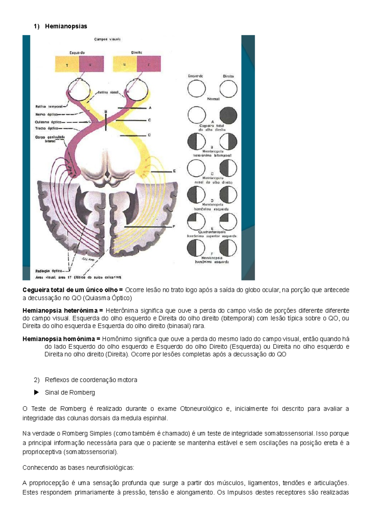 Resumo neuro 2 - 1) Hemianopsias Cegueira total de um único olho ...