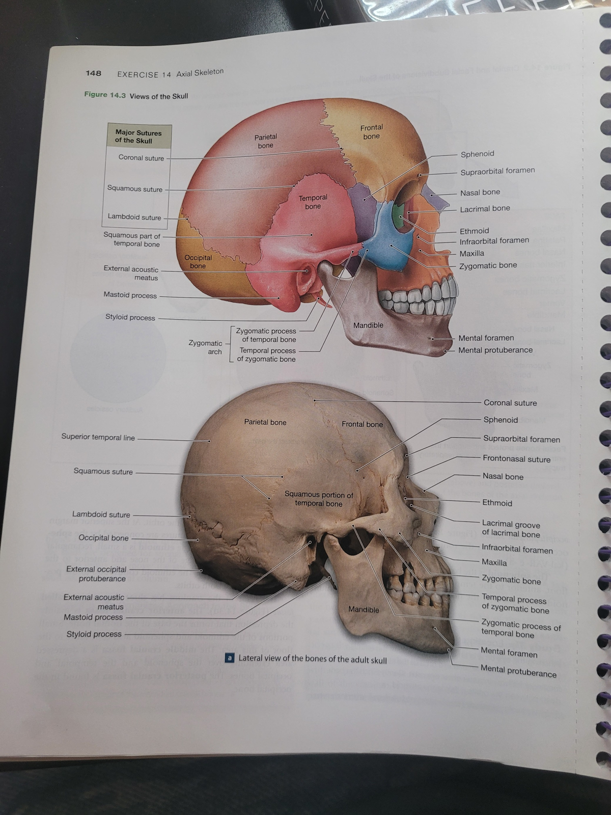 20230309 121126 - this gives you the lateral view of the skull and each ...