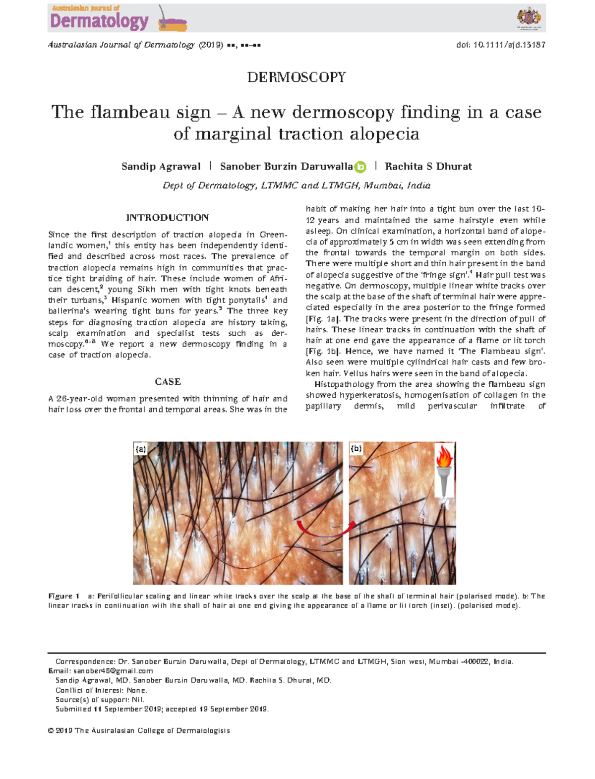 Theflambeausign - Ayshhs - DERMOSCOPY The flambeau sign – A new ...