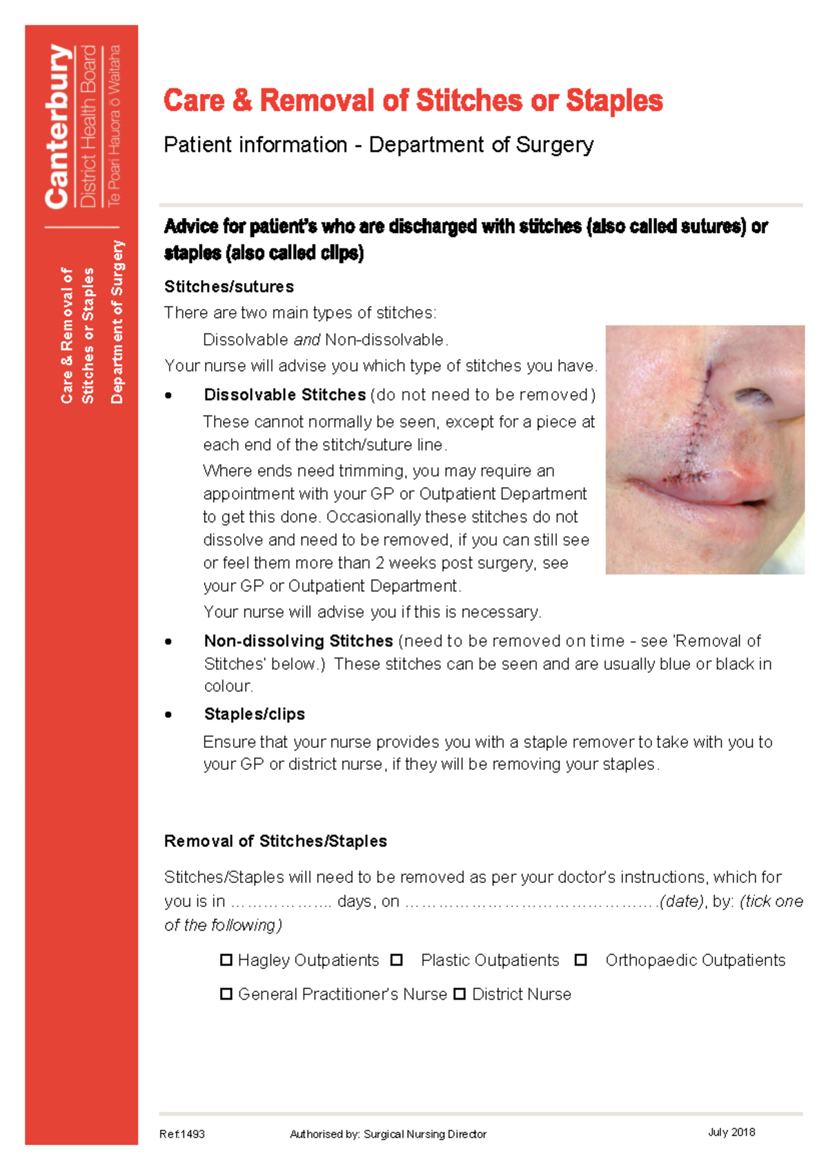 Discharge Care and Removal of Stitches or Staples 1493 - Ref:1493 ...