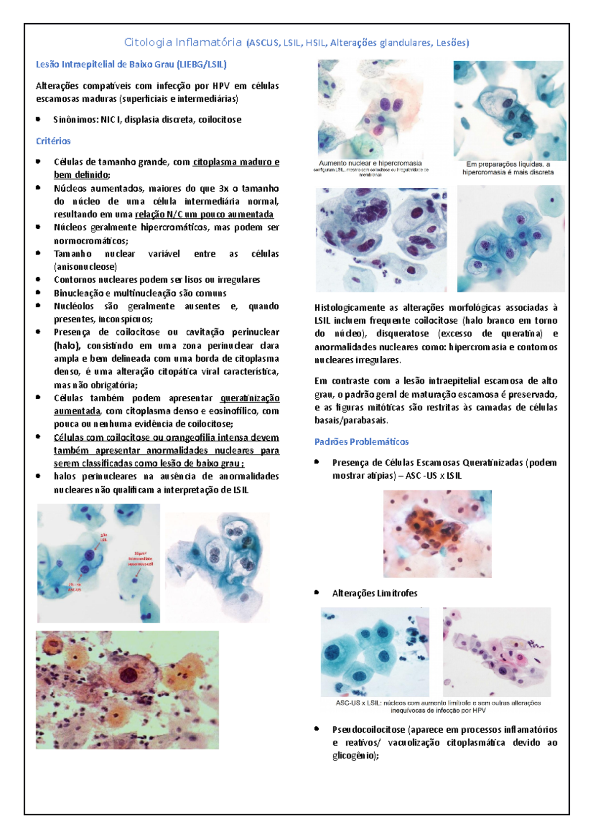 LSIL - Ascus - HSIL - Citologia Inflamatória (ASCUS, LSIL, HSIL ...